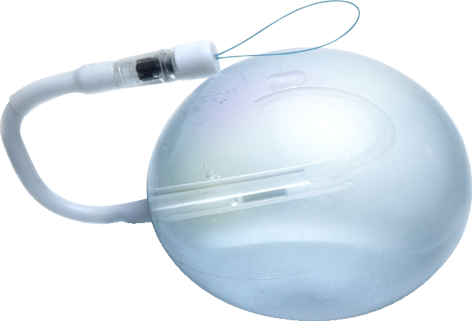 Spatz Weight Loss Balloon in Dubai - Dr. Girish Juneja